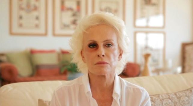 Ana Maria Braga explica motivo do “olho roxo” | VEJA SÃO PAULO